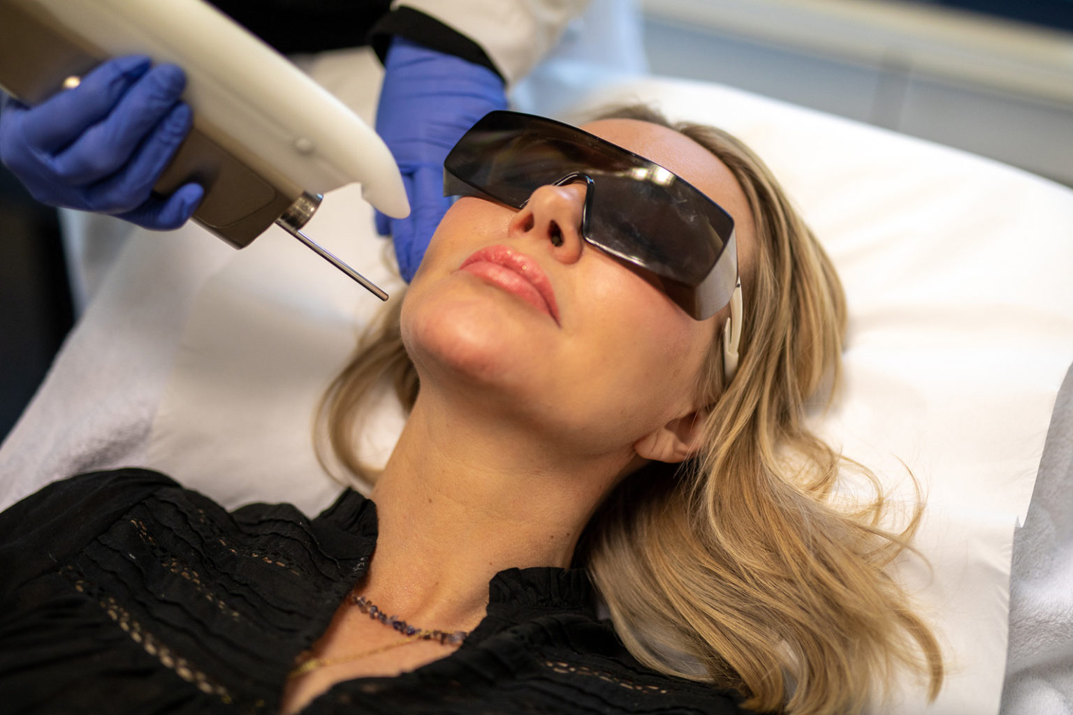 Informasjon før laserbehandling - Klinikk Estetikk